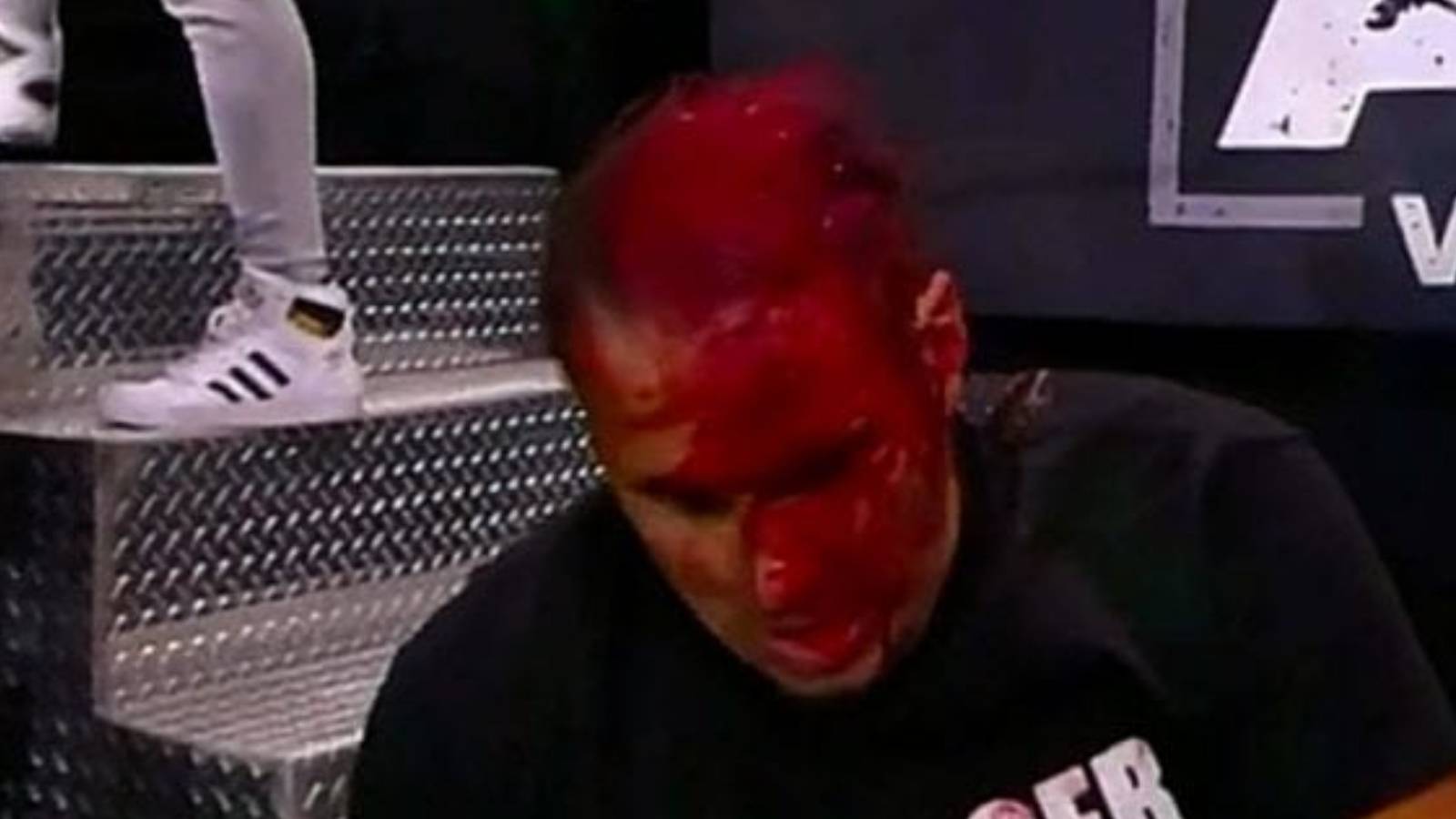 Matt Hardy's Dynamite Head Injury Was Very Real (Update On His Condition)