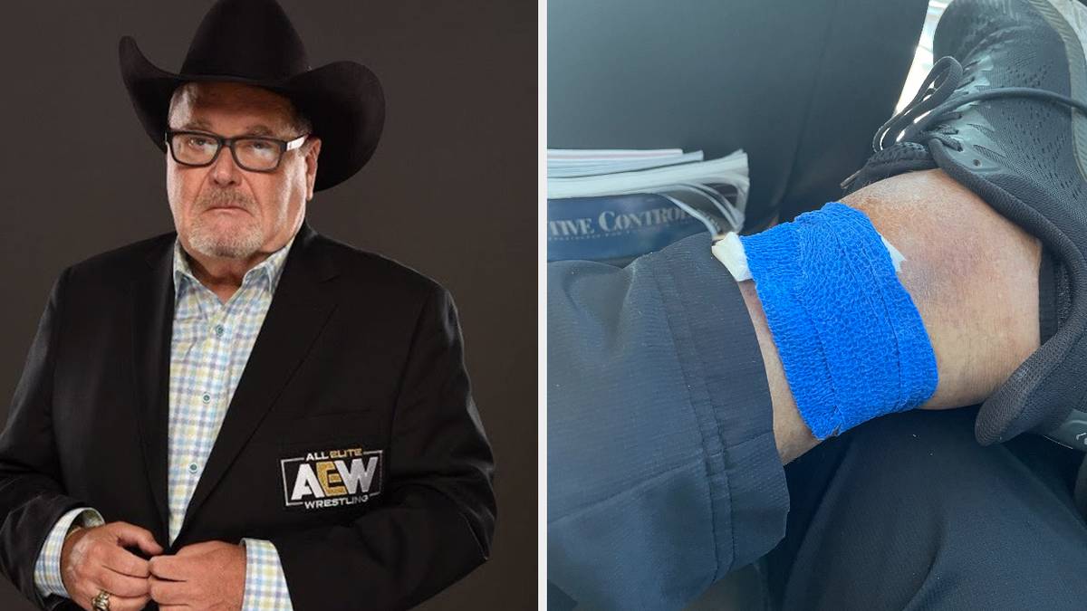 AEW's Jim Ross Confirms Skin Cancer Diagnosis