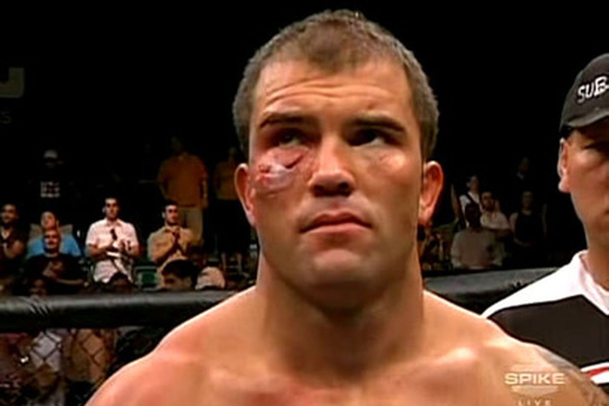 10 Most Insane Weight Cuts In UFC History