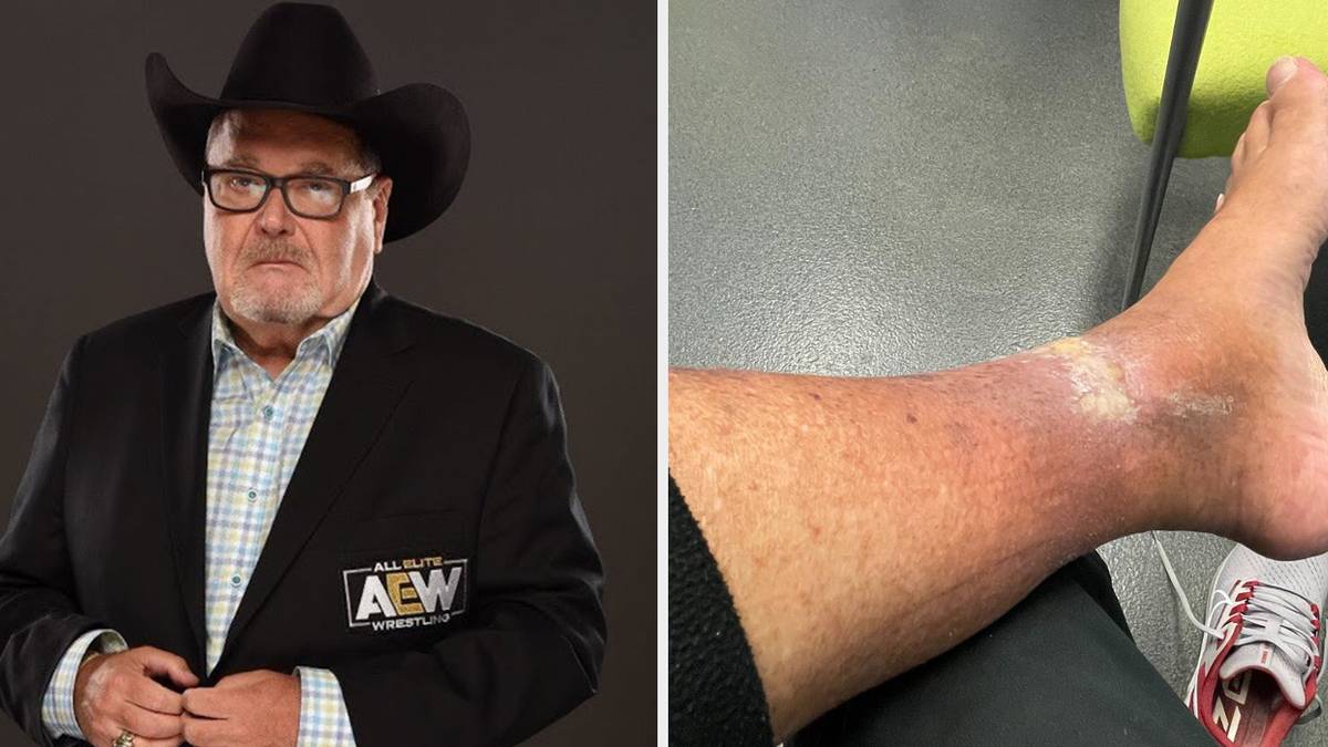 AEW's Jim Ross Beats Cancer, Returns To Work