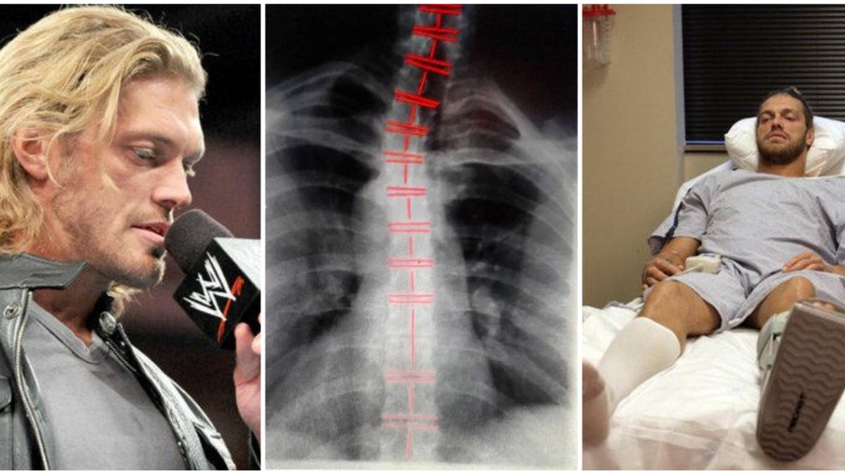 Every Major Injury Of Edge's Wrestling Career, Explained