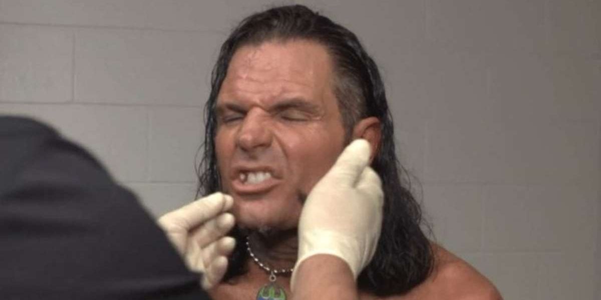 Shayna Baszler Teeth