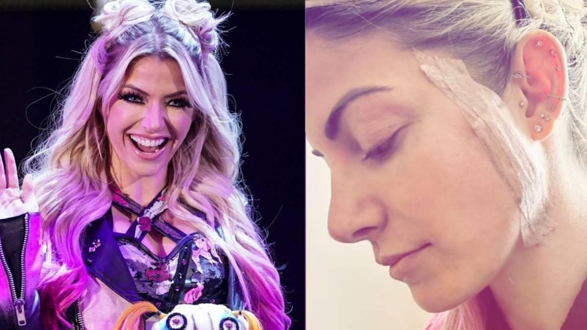 Alexa Bliss Undergoes Skin Cancer Procedure, Now "All Clear"