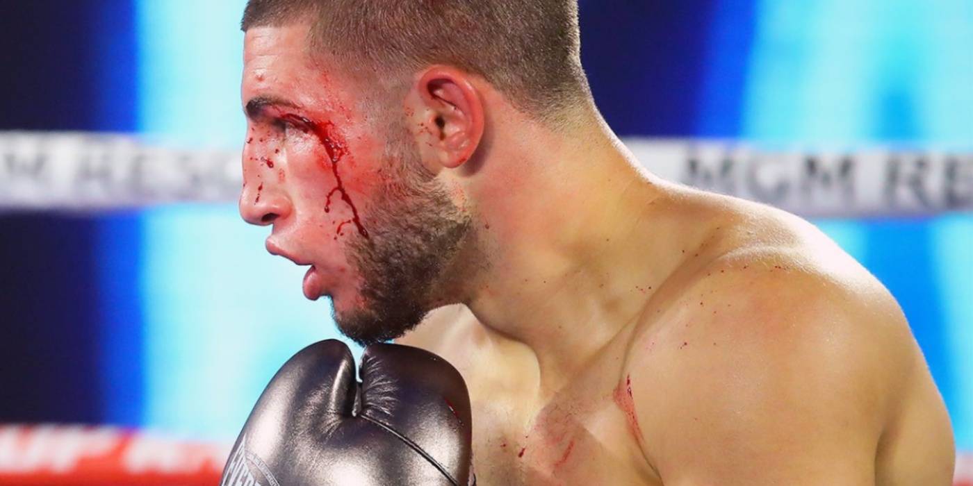 Boxer David Kaminsky Seen Spitting And Using The N-Word At Protest