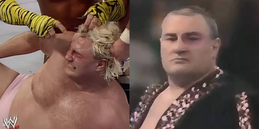 Hair Vs. Hair Match: What Pro Wrestlers Looked Like Before & After