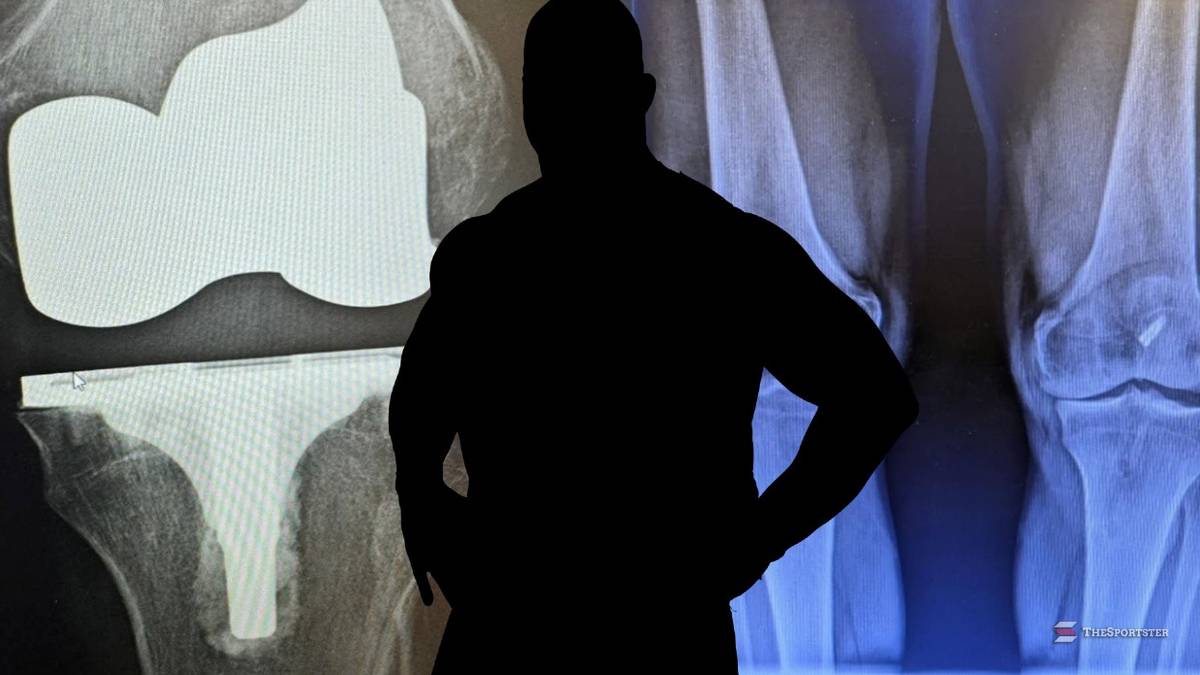WWE Legend Reveals He Had Total Knee Replacement Surgery